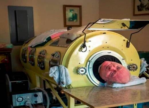 ¿Quién era Paul Alexander, “el hombre del pulmón de acero” que falleció ...