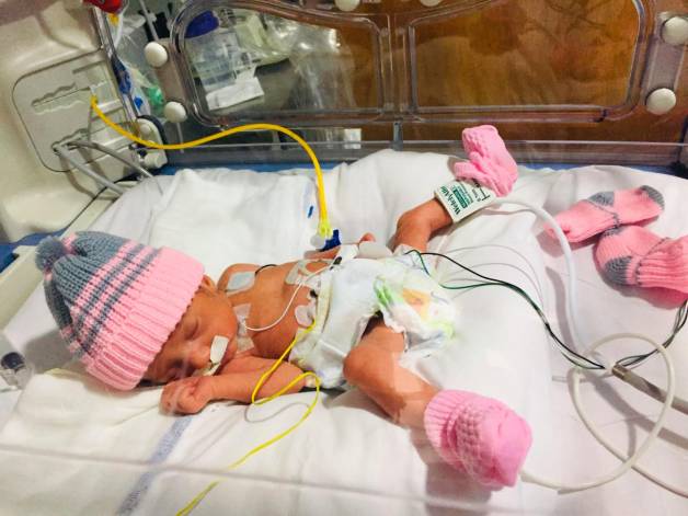 15 millones de bebés en el mundo nacen antes de tiempo