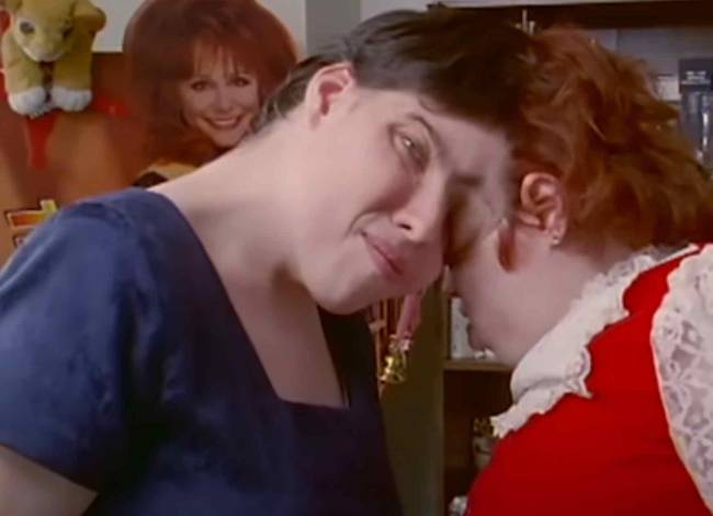 Así fue la vida de Lori y George, los siameses más longevos del mundo ...