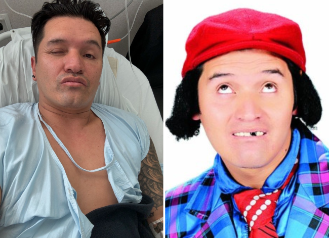 Hassam, el reconocido humorista está hospitalizado: ¿qué se sabe de su ...