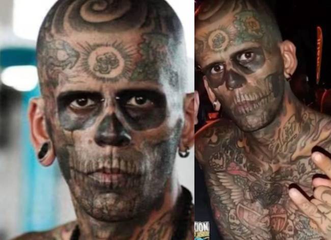 Imágenes sensibles | El hombre más tatuado de Brasil decidió quitarse todos sus tatuajes: así luce