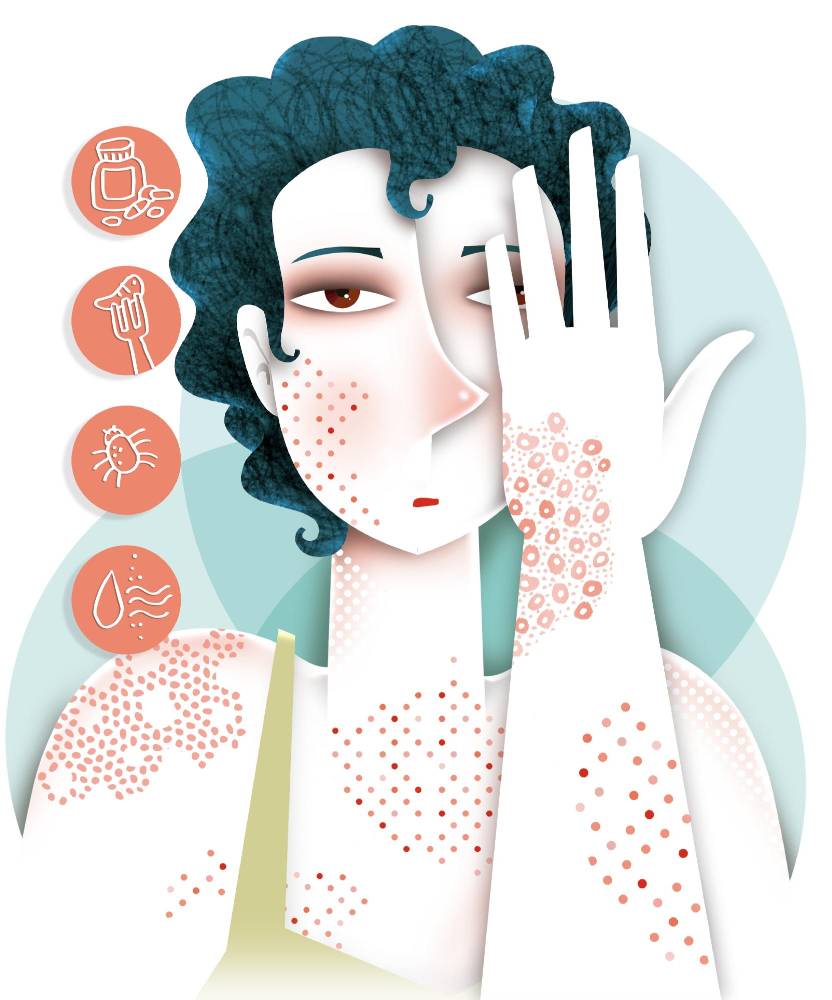 Cómo identificar las alergias